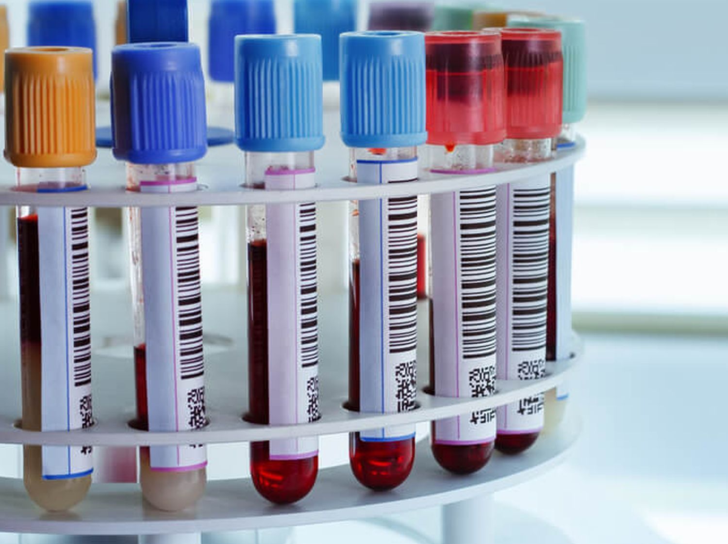 LabAnalyzer - AI-Powered Lab Results Analysis