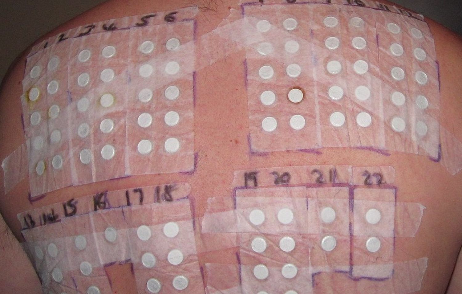 LabAnalyzer - AI-Powered Lab Results Analysis