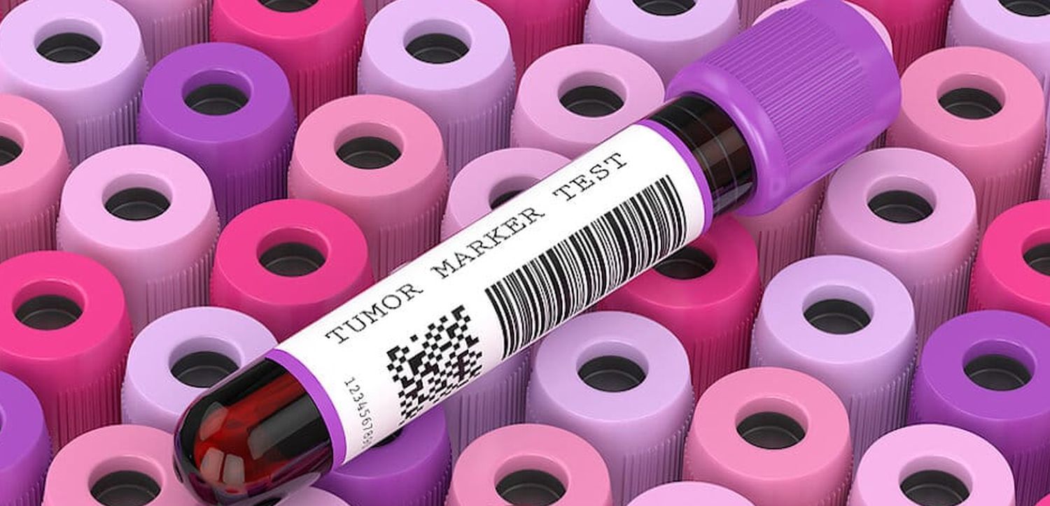 LabAnalyzer - AI-Powered Lab Results Analysis